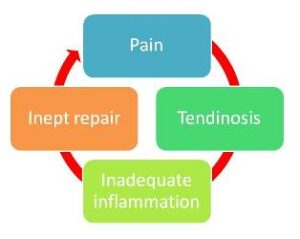 Elbow Tendinitis: The Leading Causes And How To Prevent It - Cole Pain ...