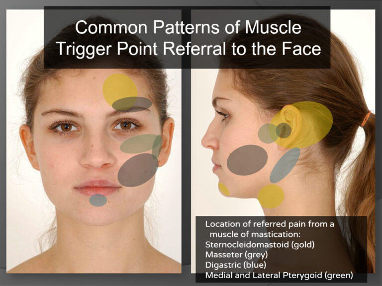 How To Spot A TMJ Problem: 5 Common Signs You Need To Know - Cole Pain ...