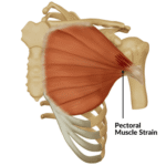 Pectoral Muscle Strain Treatment | Chest Pain Relief
